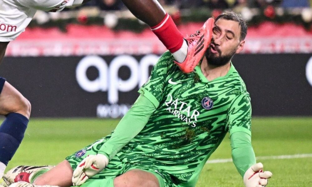 Страшно, Донарума го покажа лицето по повредата на мечот со Монако, лицето унаказено (ФОТО ...